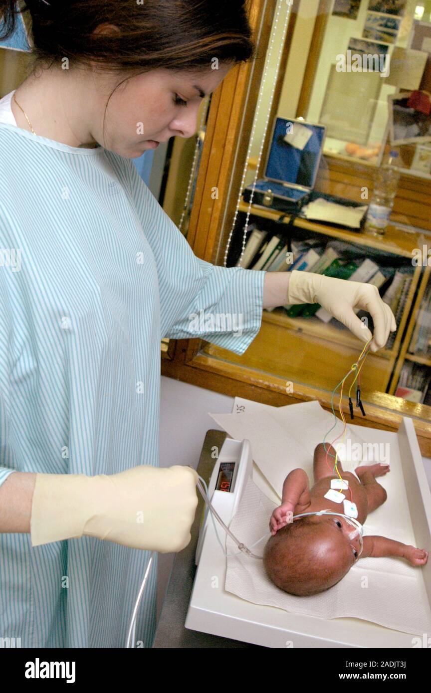 MODEL RELEASED. Premature baby monitoring. Nurse weighing a premature ...