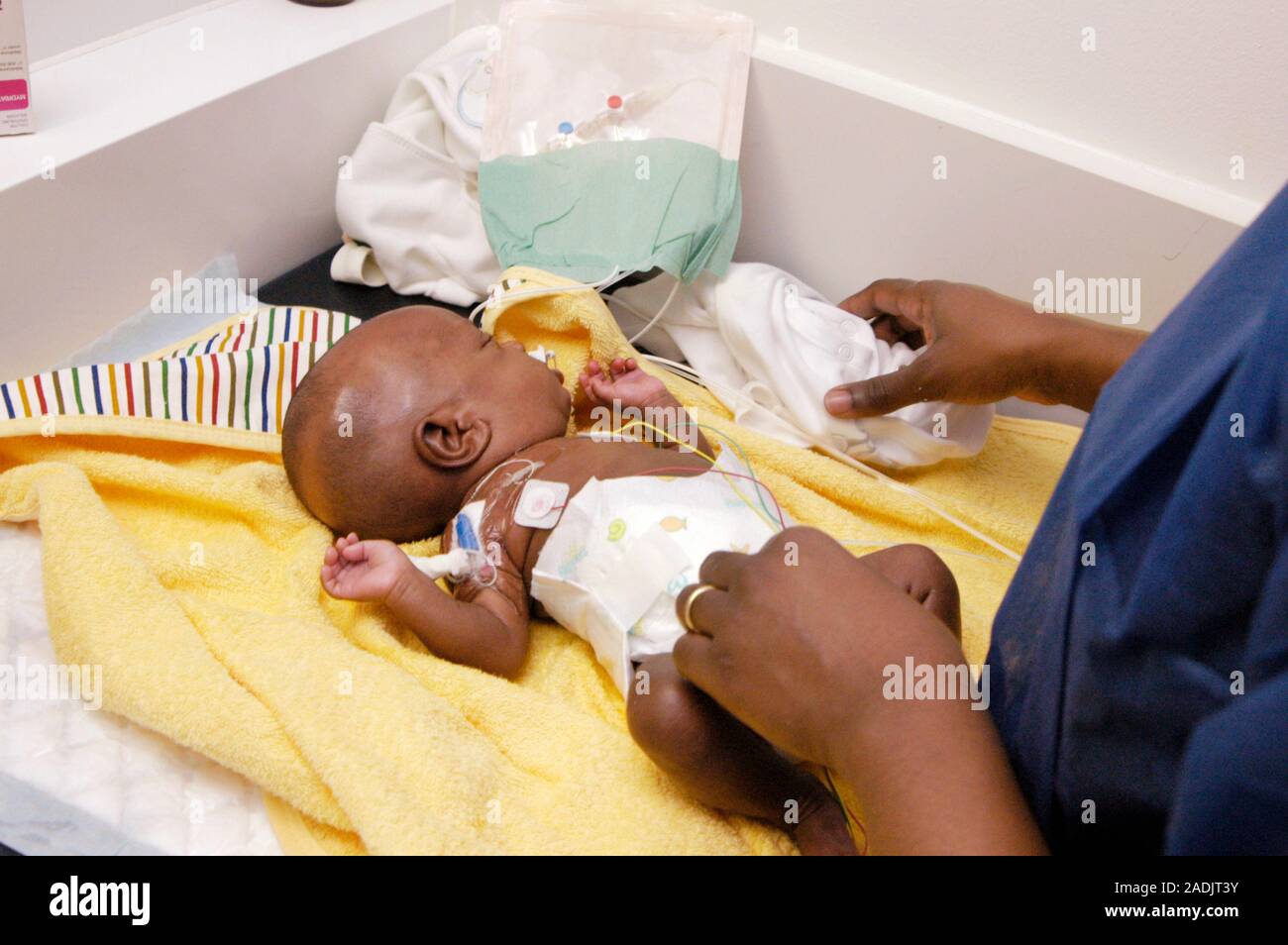 MODEL RELEASED. Premature baby. Mother attending to her premature baby ...
