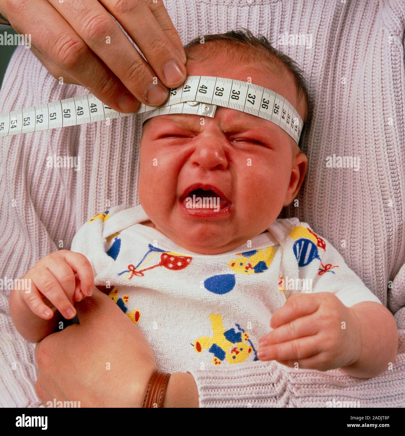 Paediatric examination. The circumference of a 6-week-old baby's head ...