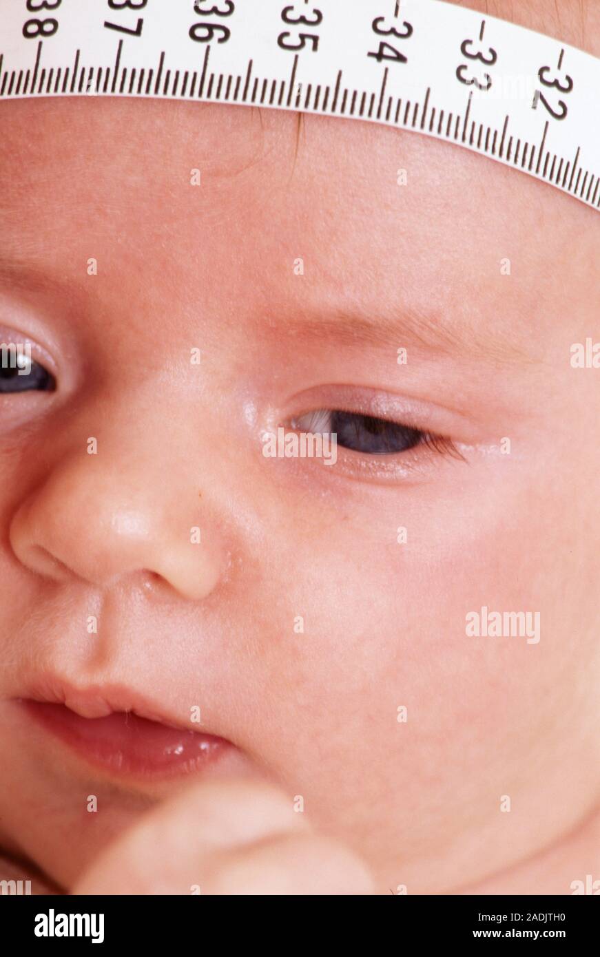 Paediatric examination. Tape measure being used to measure the ...