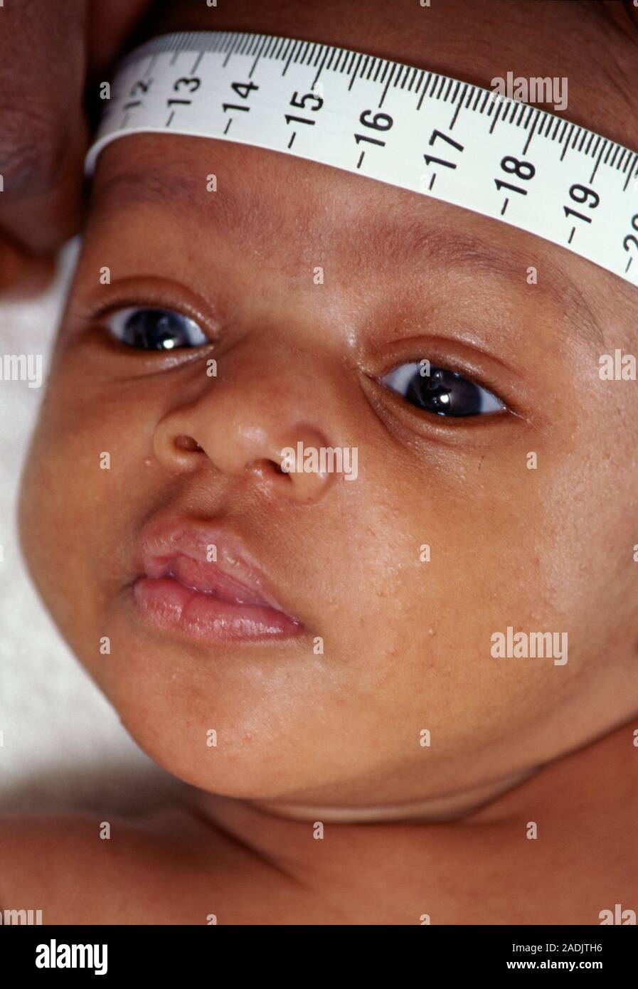 Paediatric examination. Tape measure being used to measure the ...