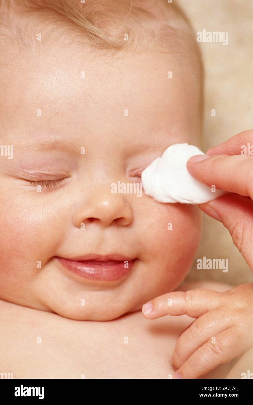 Cleaning baby. Mother cleaning the right eye of her 7-month-old baby ...