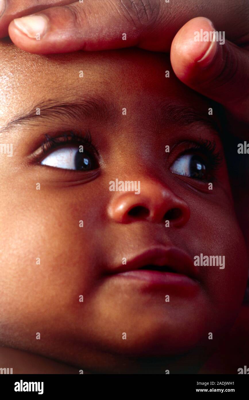 Baby girl. Hand touching the forehead of a 9-month-old baby girl Stock ...
