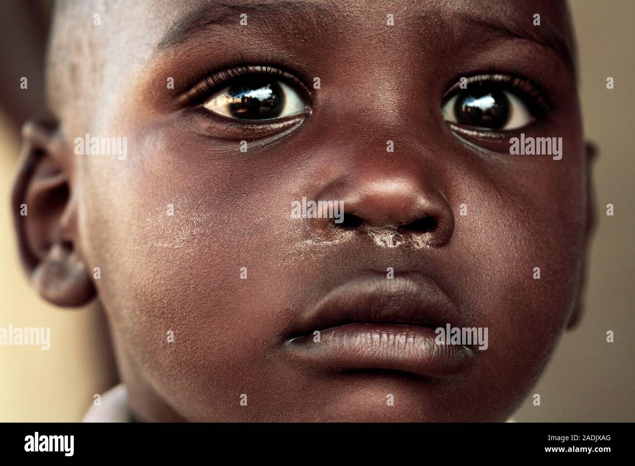 MODEL RELEASED. Young boy's face. Photographed in Gulu, Uganda Stock ...