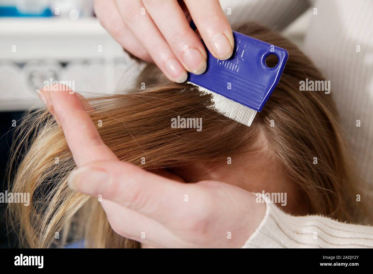 Head lice combing. Special comb being used by a mother to remove dead head lice and nits from ...