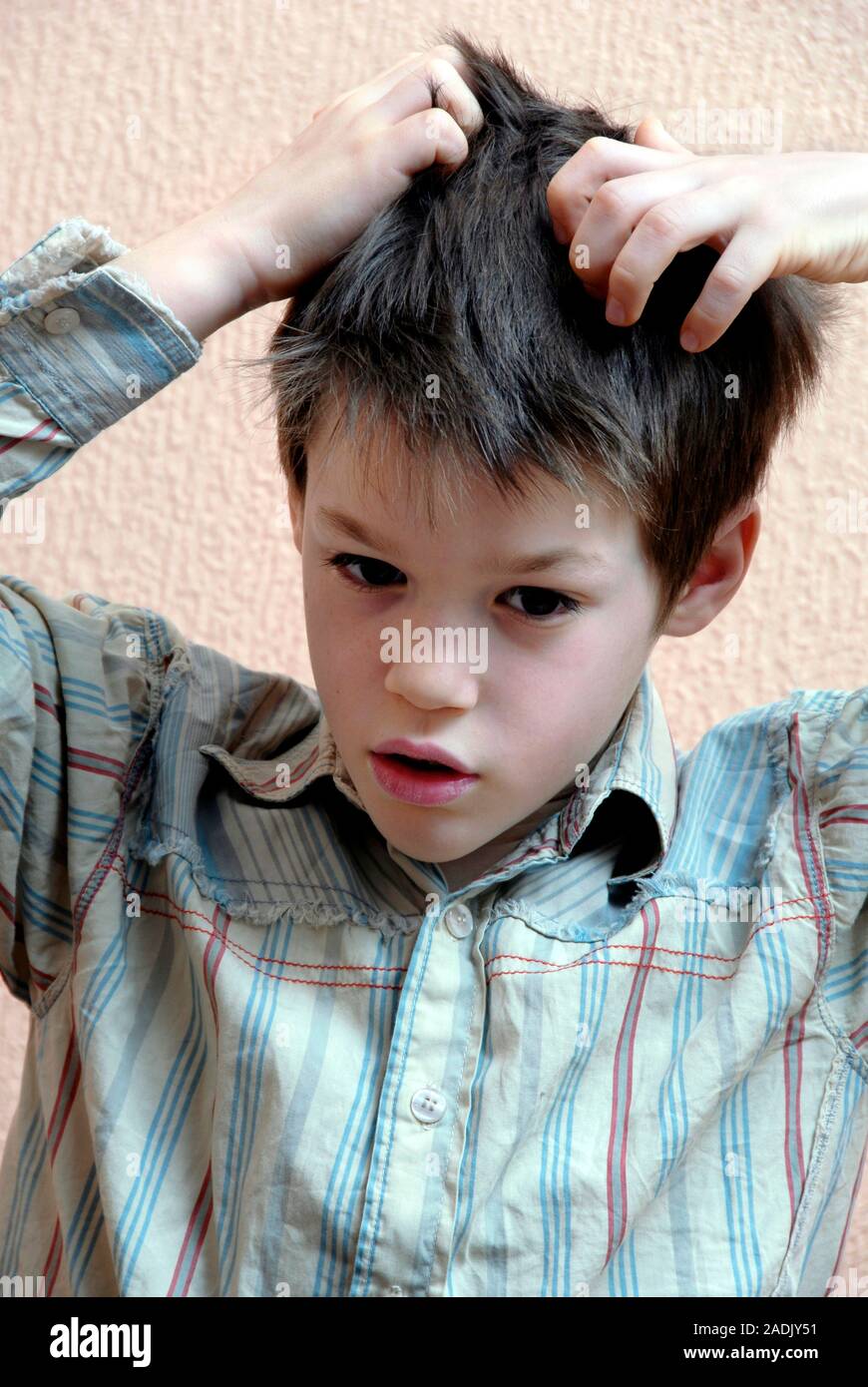 MODEL RELEASED. Head lice. Boy scratching his scalp to relieve the ...