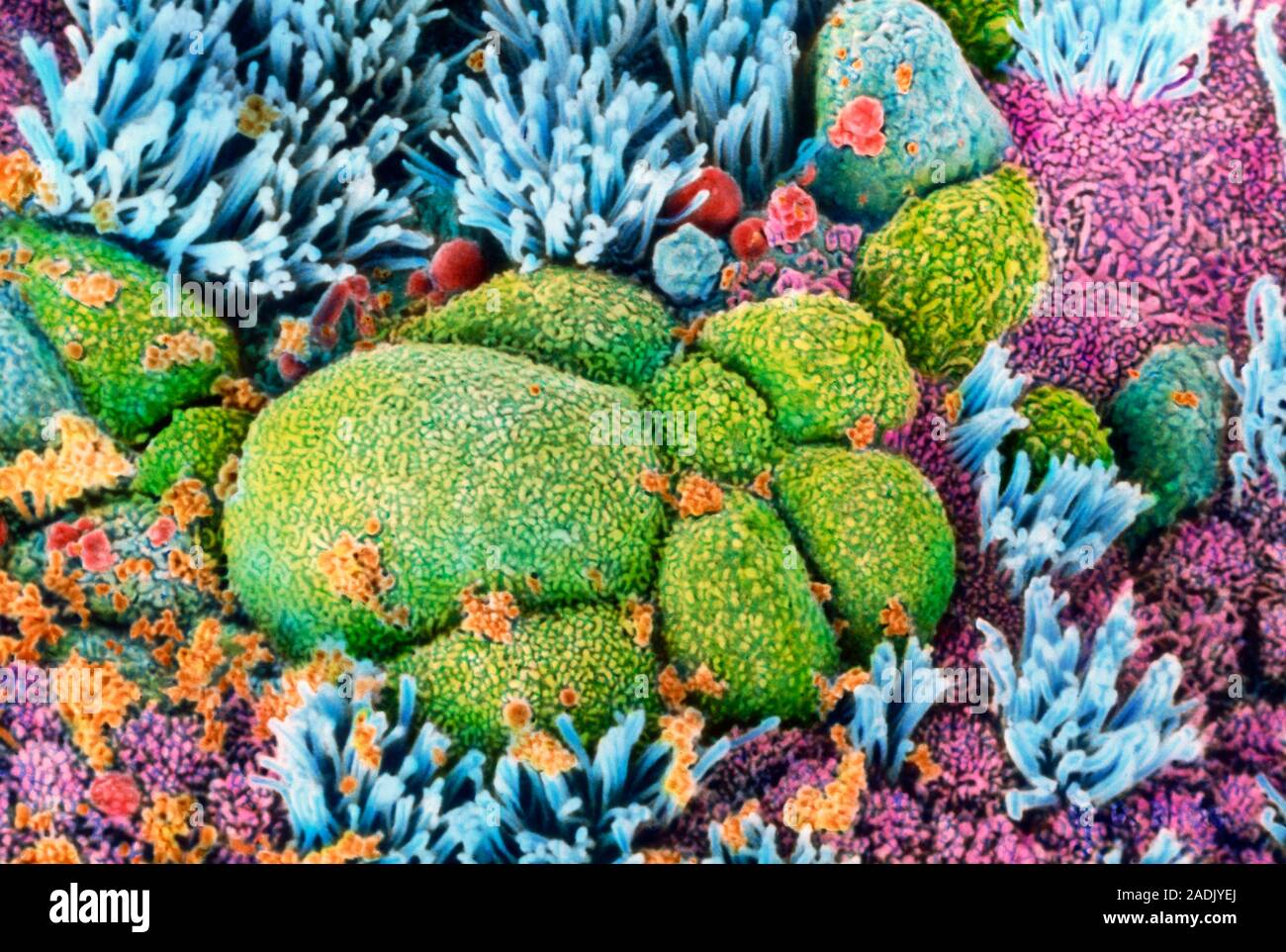 Uterine hyperplasia. Coloured scanning electron micrograph (SEM) of the ...