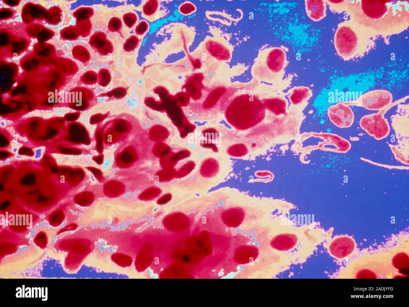 Cervical cells. Colour-enhanced light micrograph of healthy cervical ...