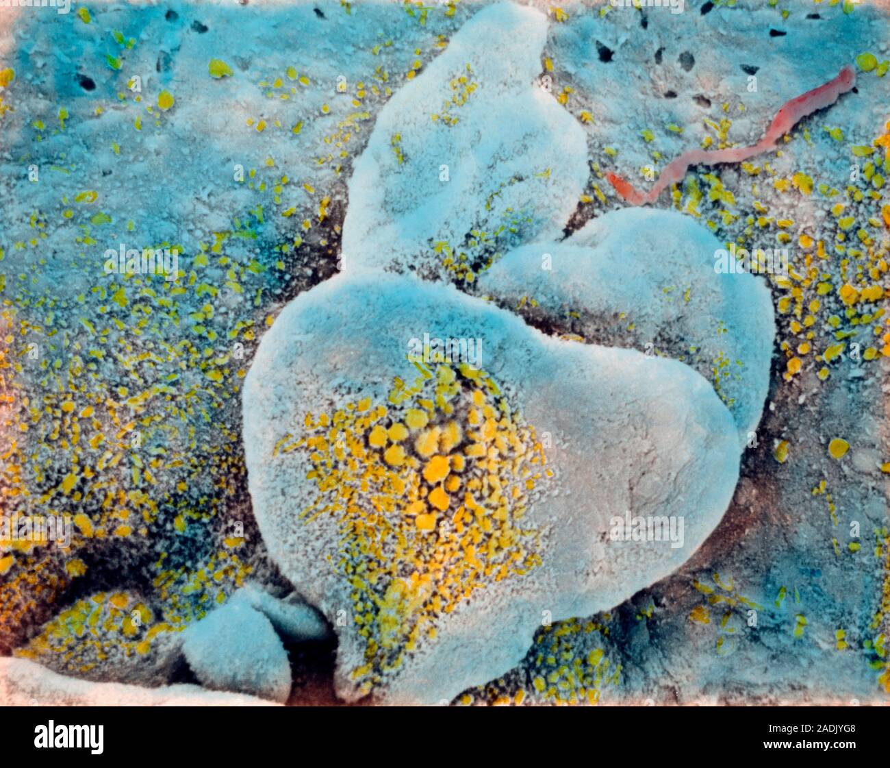 Ectopic pregnancy. Coloured scanning electron micrograph (SEM) of ...