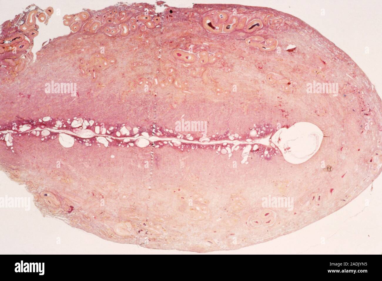Uterus Slide Labeled Uterus: Anatomy, Blood Supply, Histology,