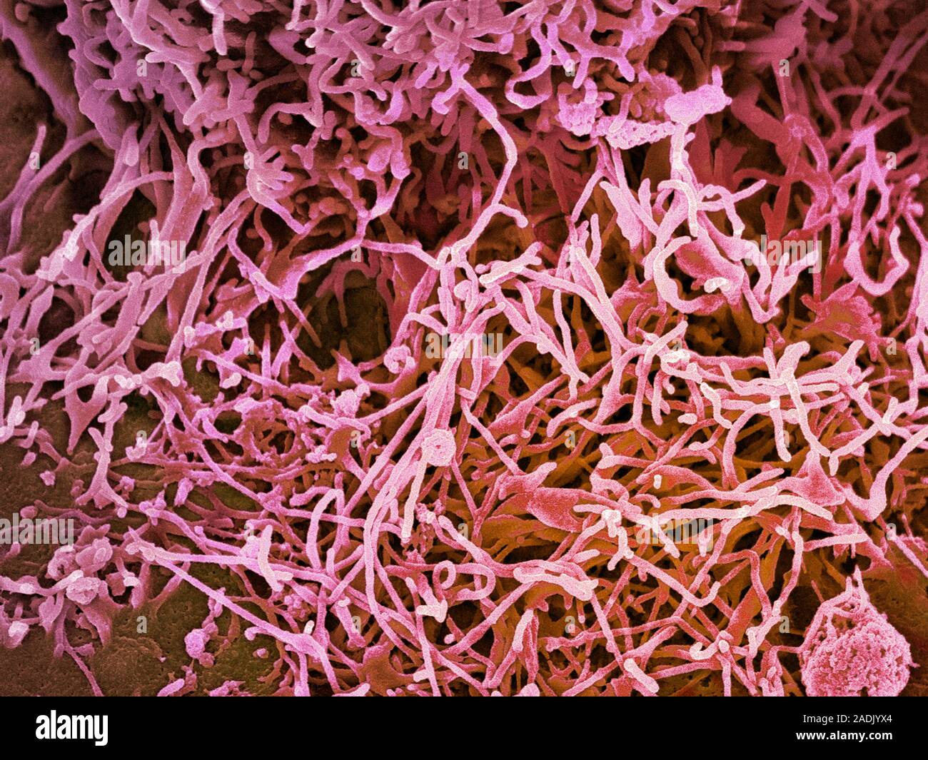 Surface of a cancer cell. Coloured scanning electron micrograph (SEM ...