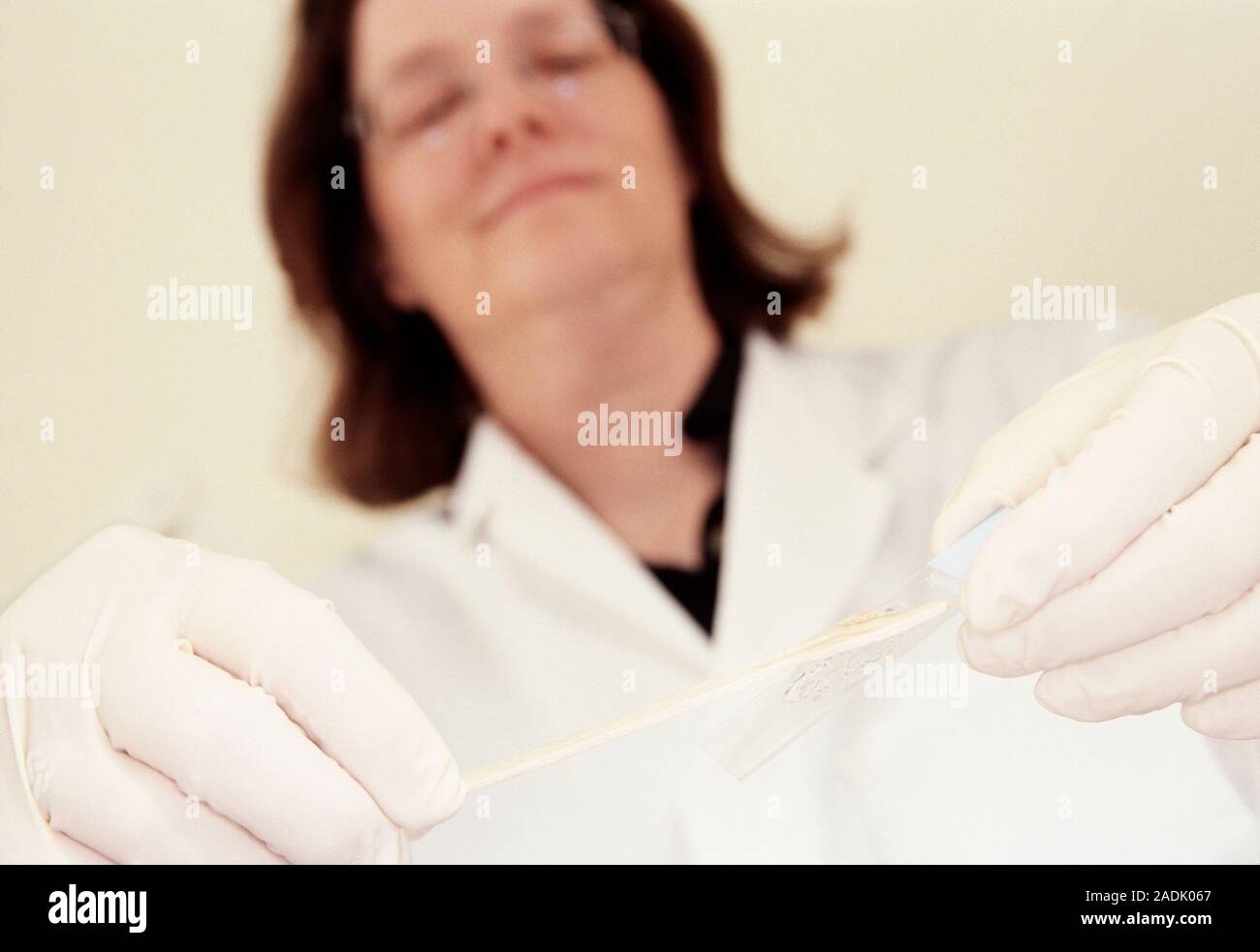 Cervical smear. Gynaecologist wiping a cell sample onto a glass slide ...