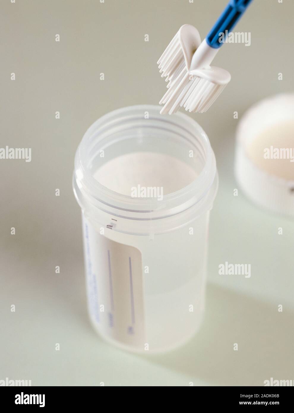 Cervical smear test. Equipment used to collect cells from the uterine ...