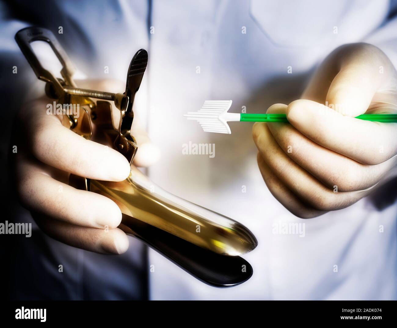 Smear test equipment. Doctor holding a duck-billed speculum (left) and ...