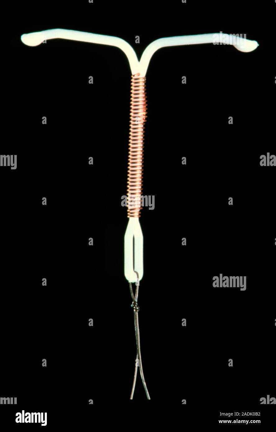 IUD. Close-up of a type of Intrauterine Contraceptive Device (IUD ...
