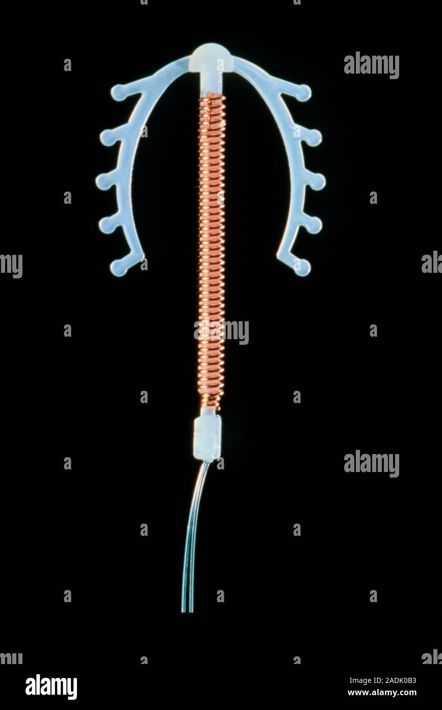 IUD. Close-up of a type of Intrauterine Contraceptive Device (IUD ...