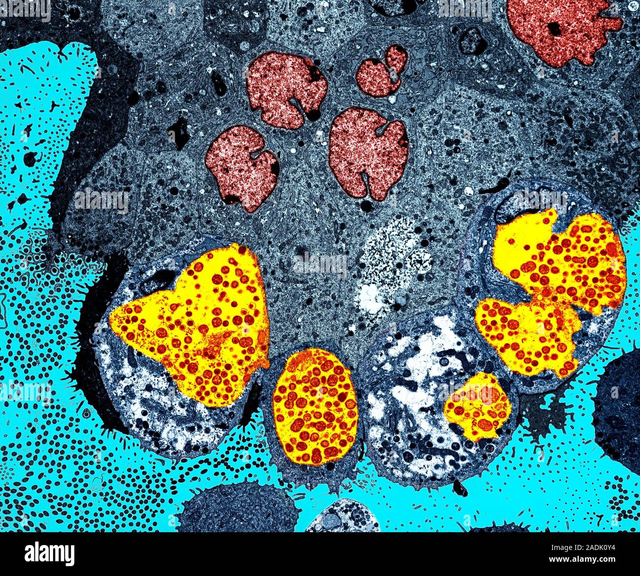 Chlamydia infection. Coloured transmission electron micrograph (TEM) of ...