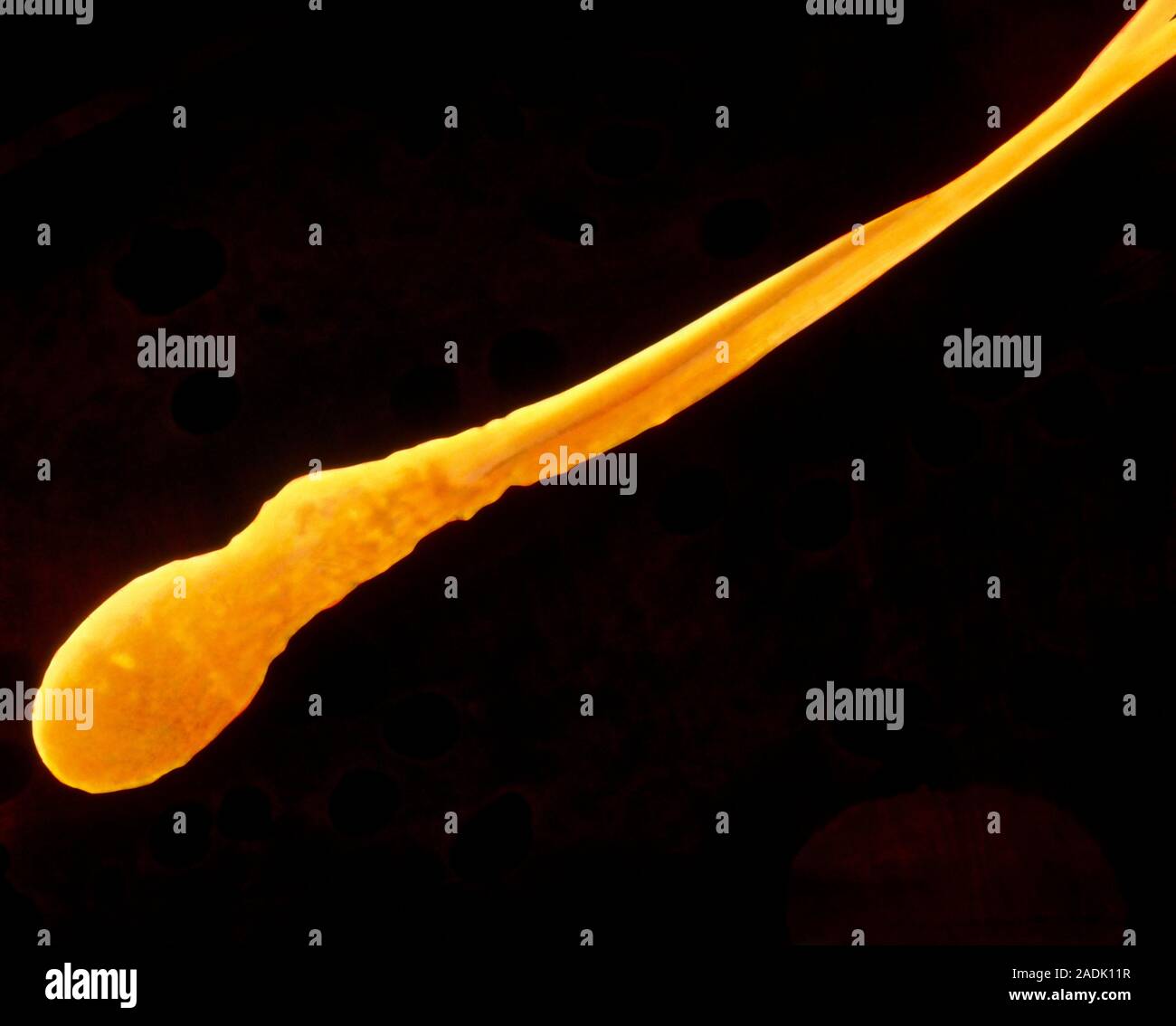 Deformed spermatozoon. Coloured scanning electron micrograph showing a ...