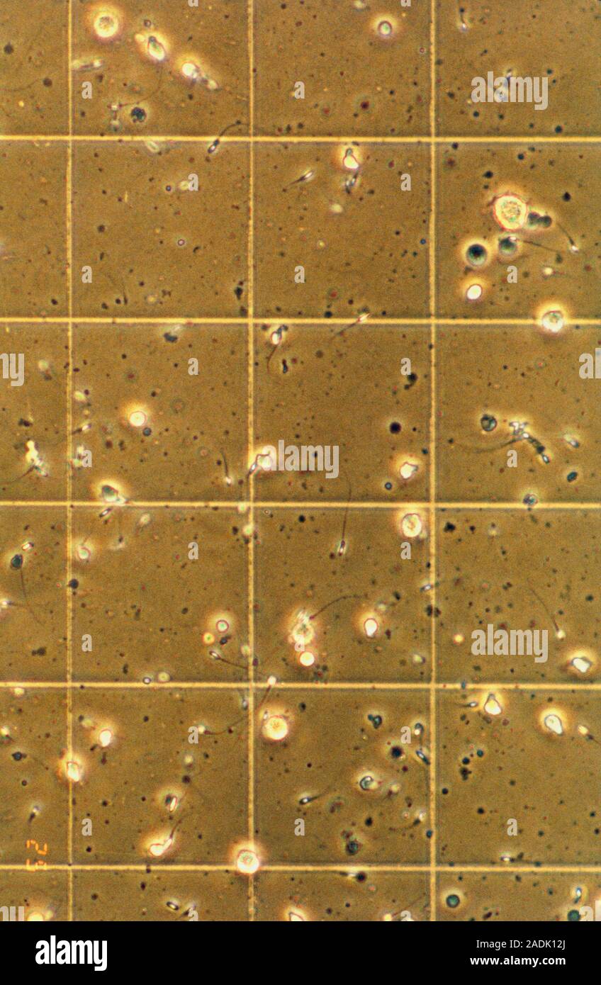 Sperm count. Light micrograph with graticular screen showing a field of ...