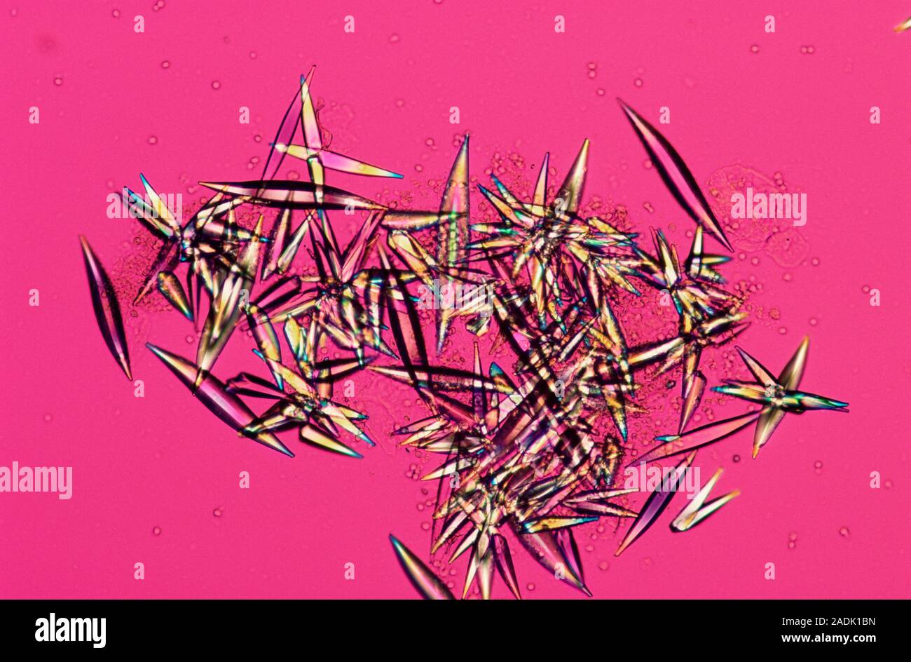 Crystals in seminal fluid. Polarised light micrograph of a sample of ...