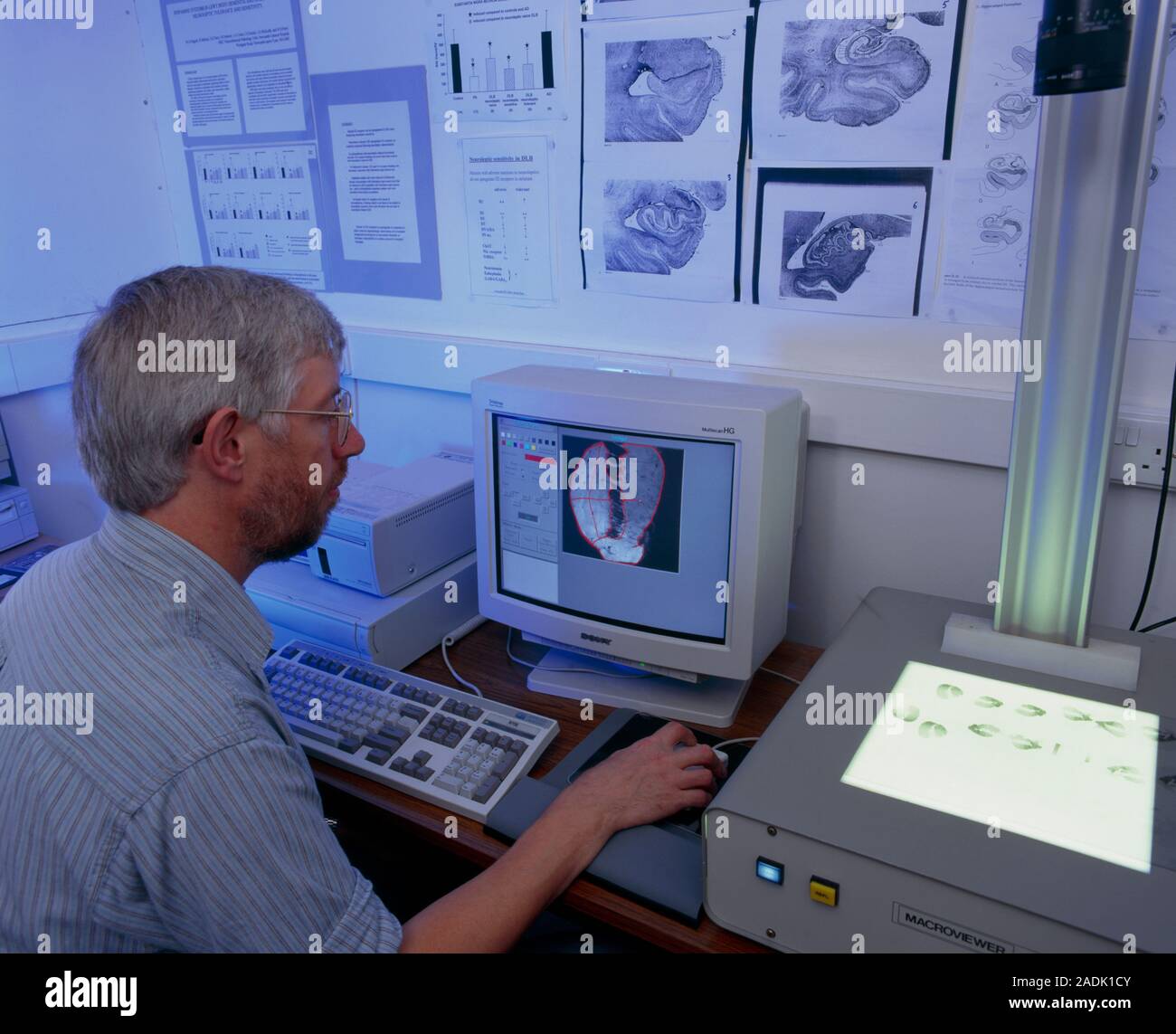 Dopamine research. Study into the abundance of dopamine D2 receptors in ...