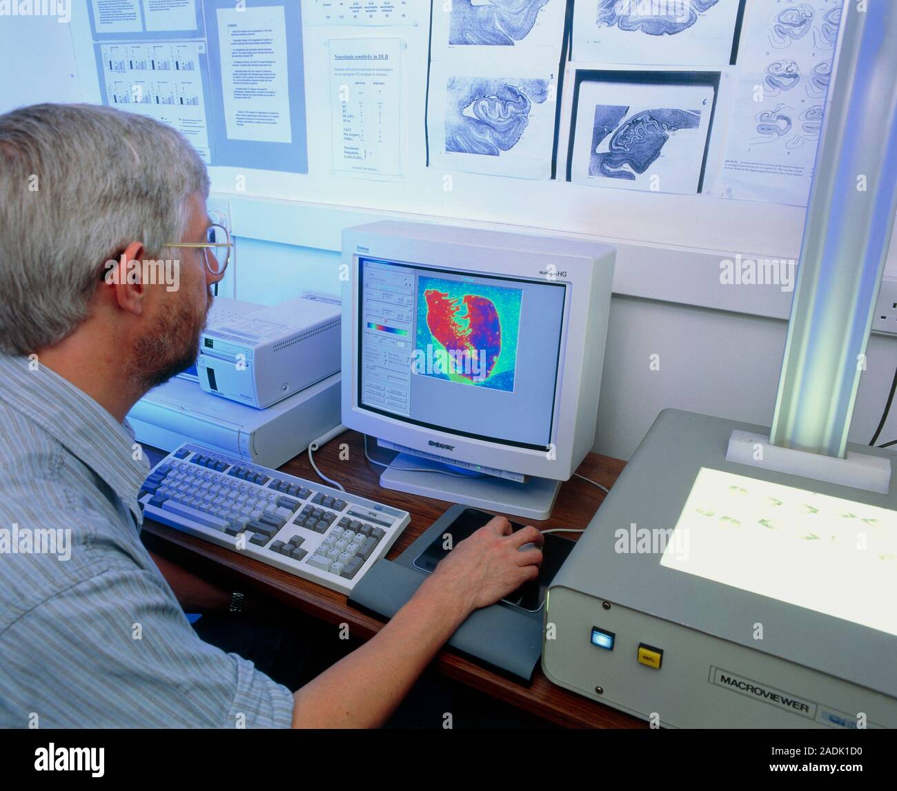 Dopamine research. Study into the abundance of dopamine D2 receptors in ...