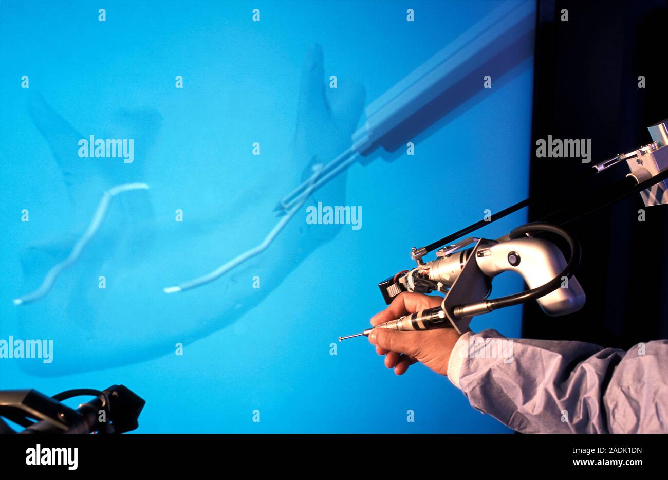 Surgical planning. Surgical device being used to plan and prepare for ...