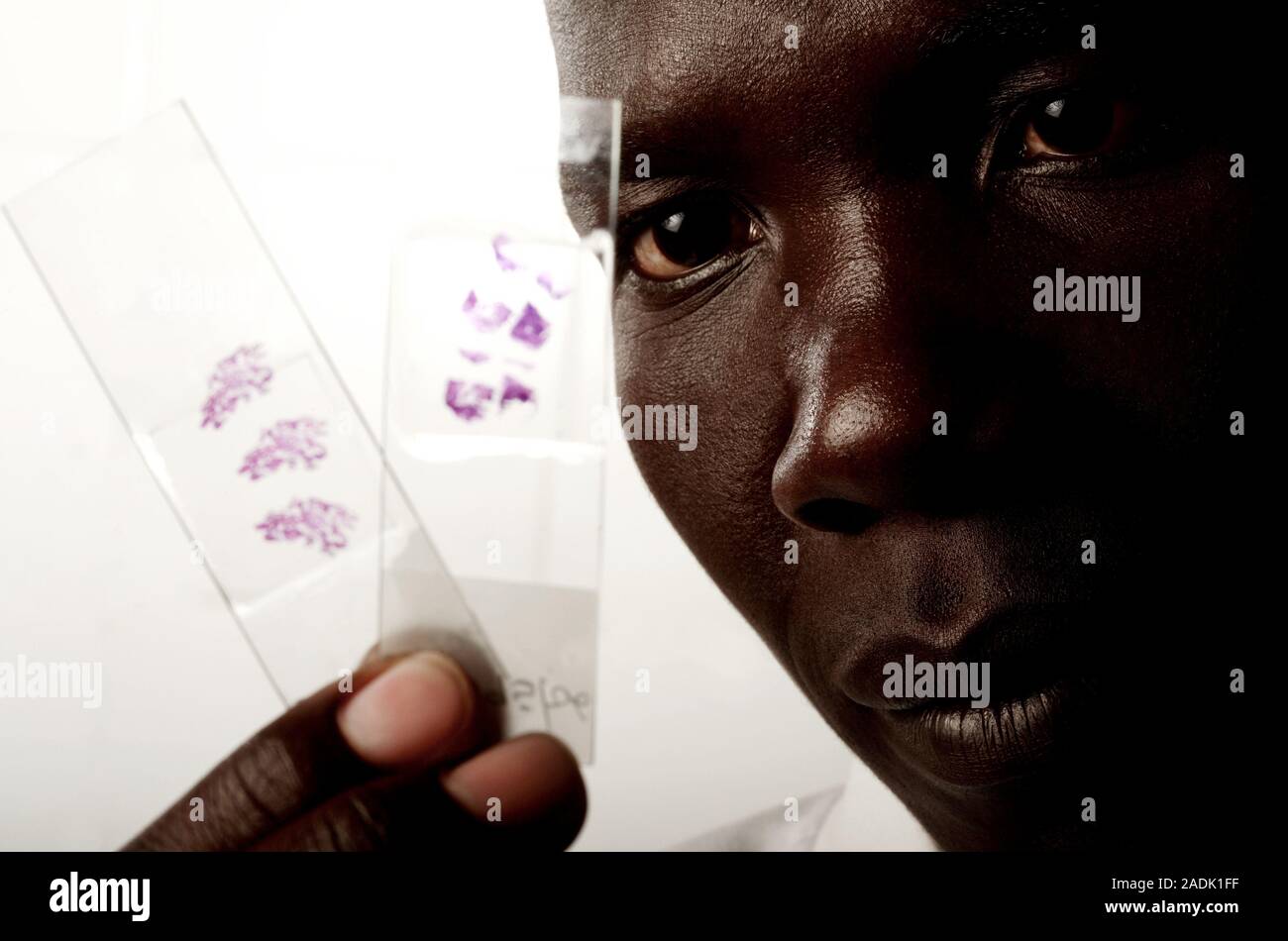 Medical research. Histologist examining glass slides. These slides ...