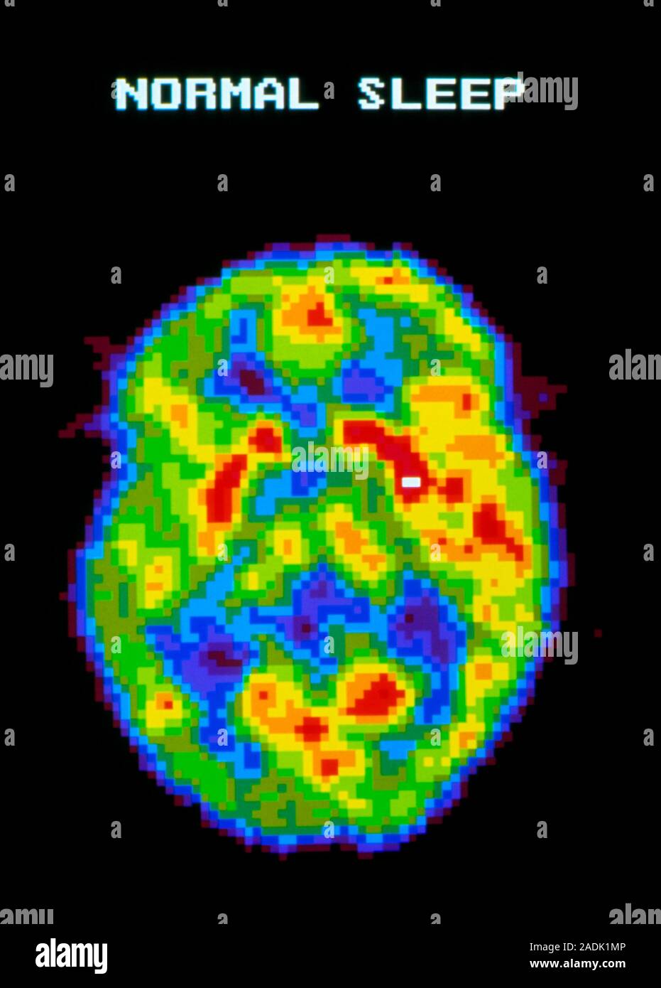 Brain during normal sleep. Coloured Positron Emission Tomography (PET ...