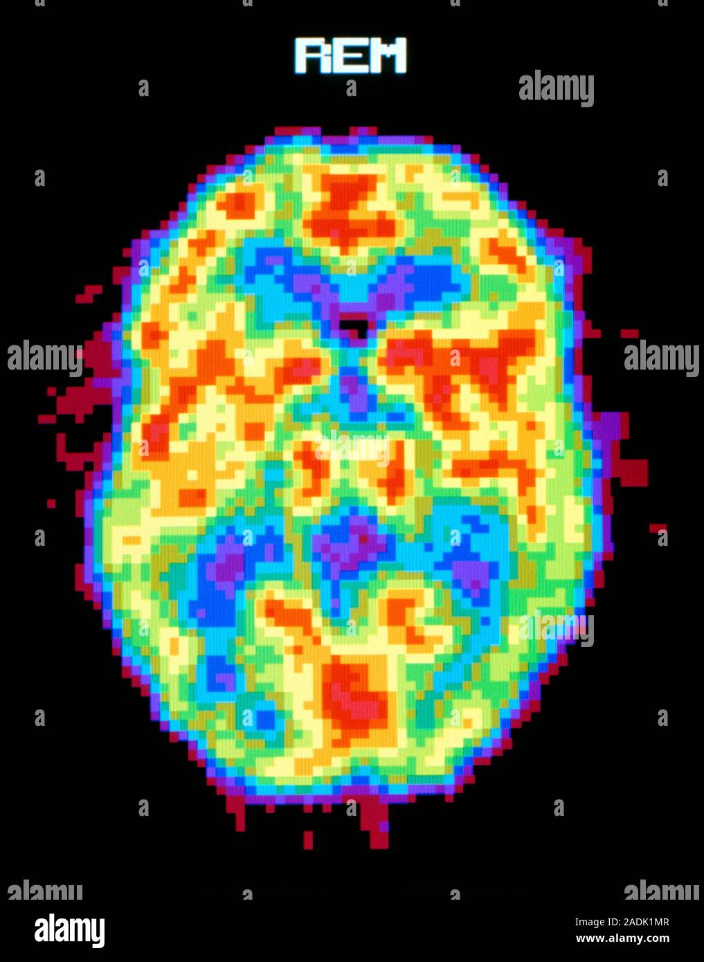 Brain during REM sleep. Coloured Positron Emission Tomography (PET ...