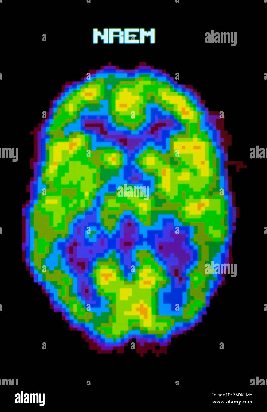 Brain during NREM sleep. Colour Positron Emission Tomography (PET) scan ...