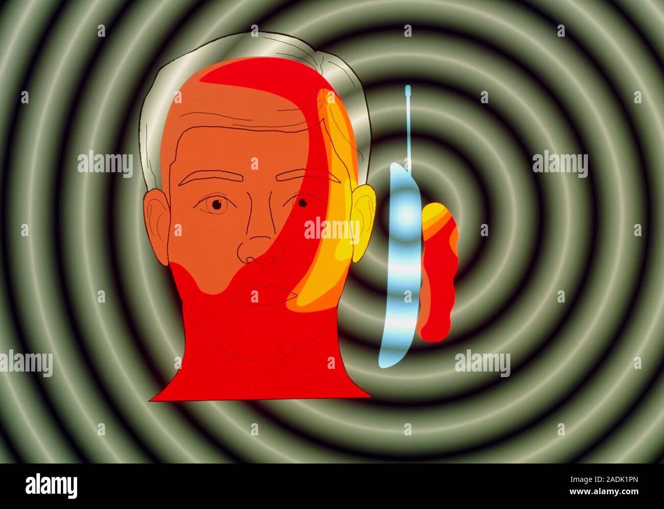 Mobile telephone effect. Artwork showing the microwave exposure levels ...