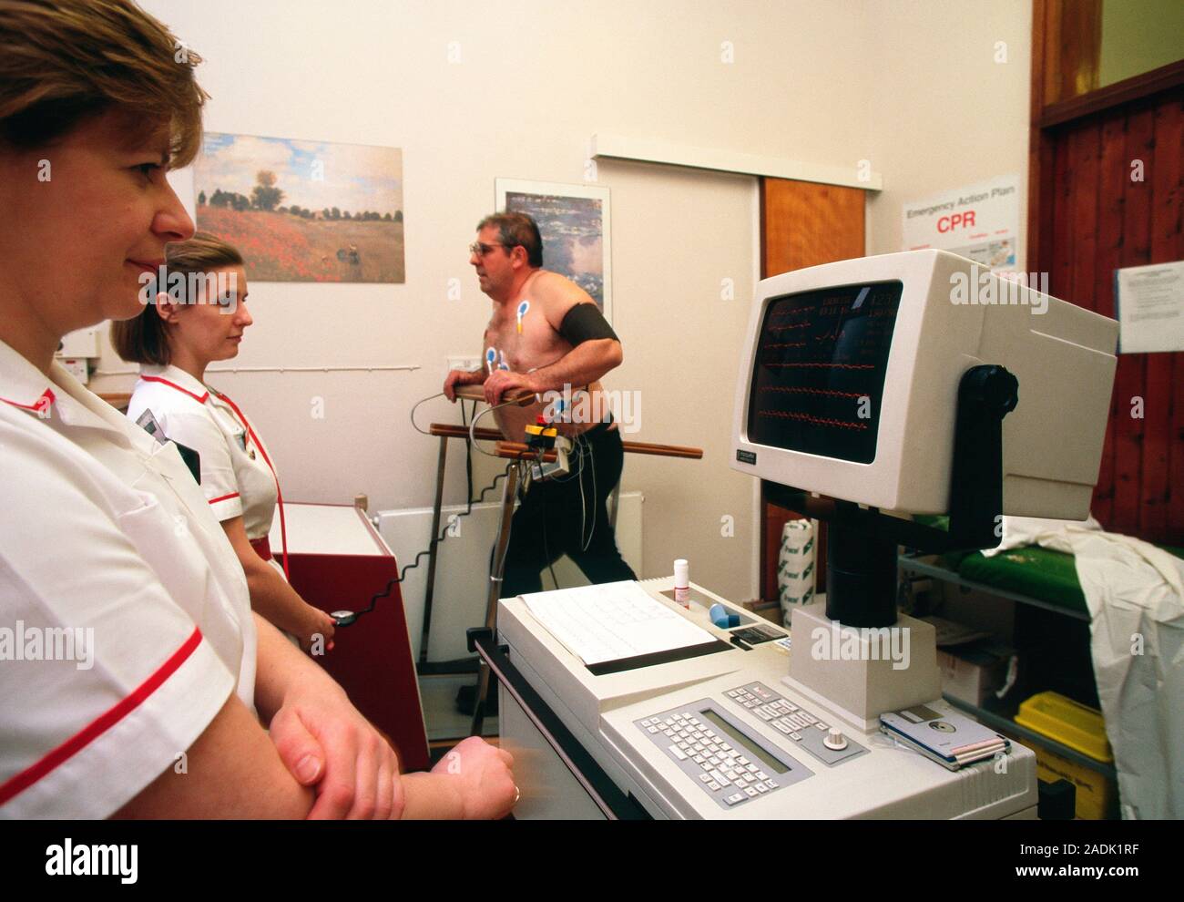 Stress test. Nurses monitoring a patient as he performs exercise on a ...
