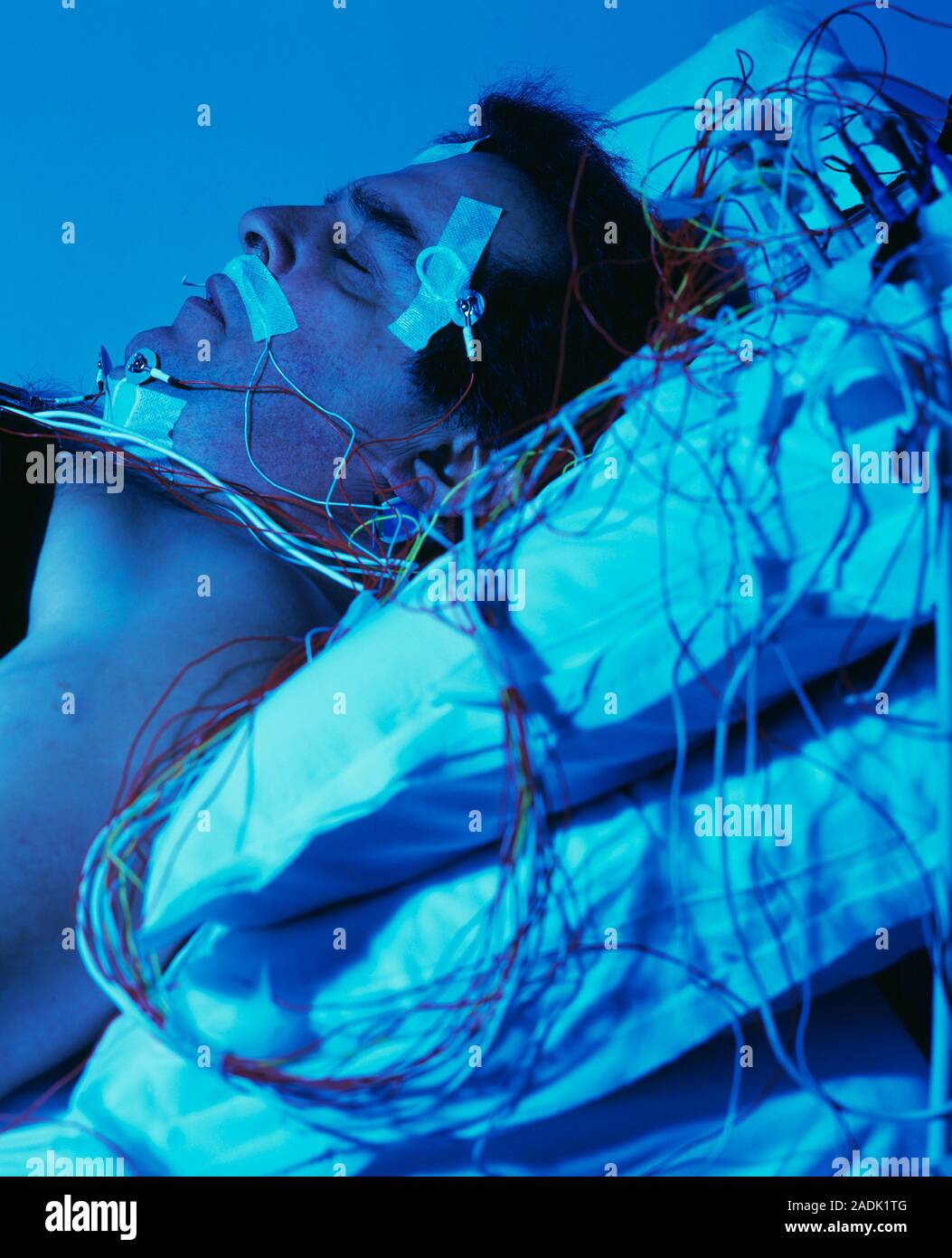 Sleep research. Sleeping man being monitored during research into sleep ...