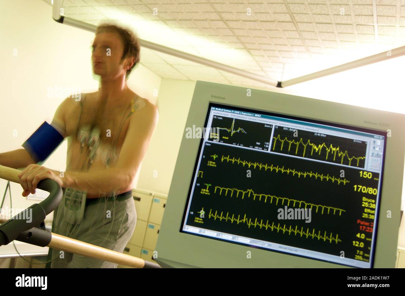 Fitness test. Man walking on a treadmill during a fitness test ...