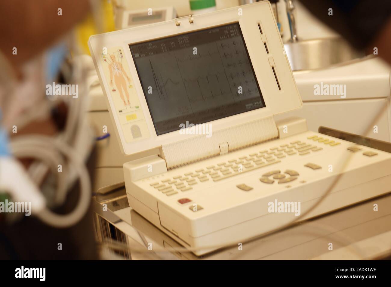 Heart fitness test. Electrocardiogram (ECG) device showing the output ...