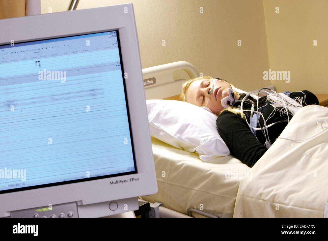 Model Released Sleep Apnoea Research Young Woman Attached To