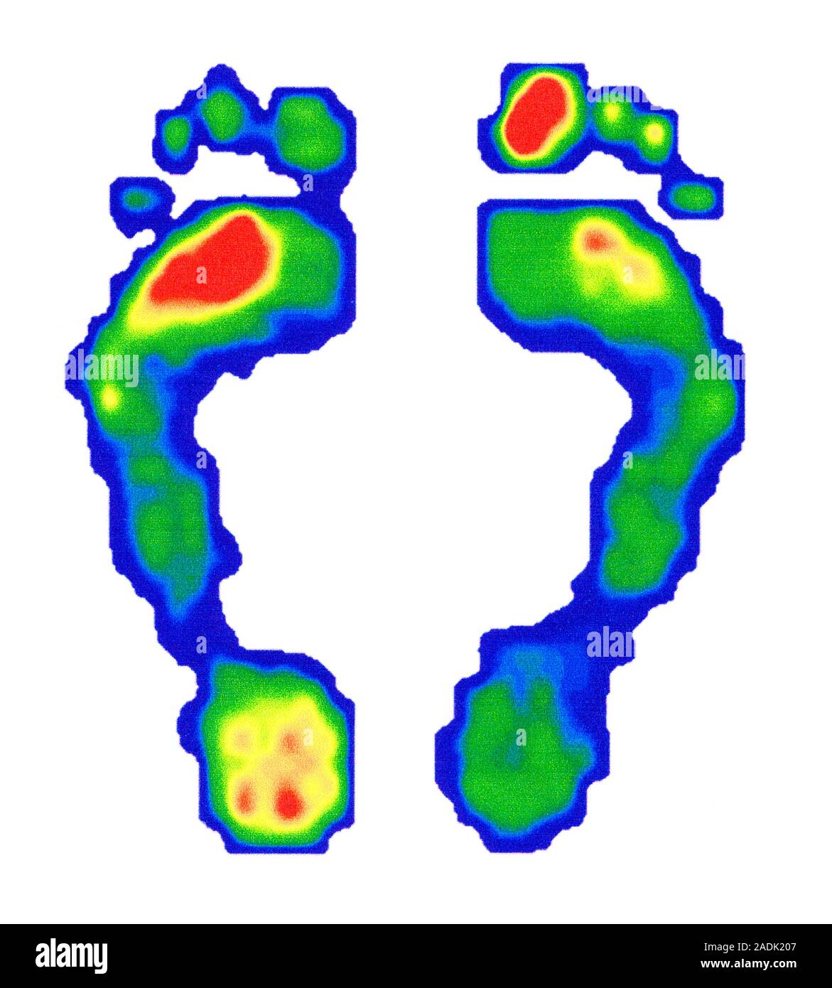 Footprints showing weight distribution during running. The colours ...