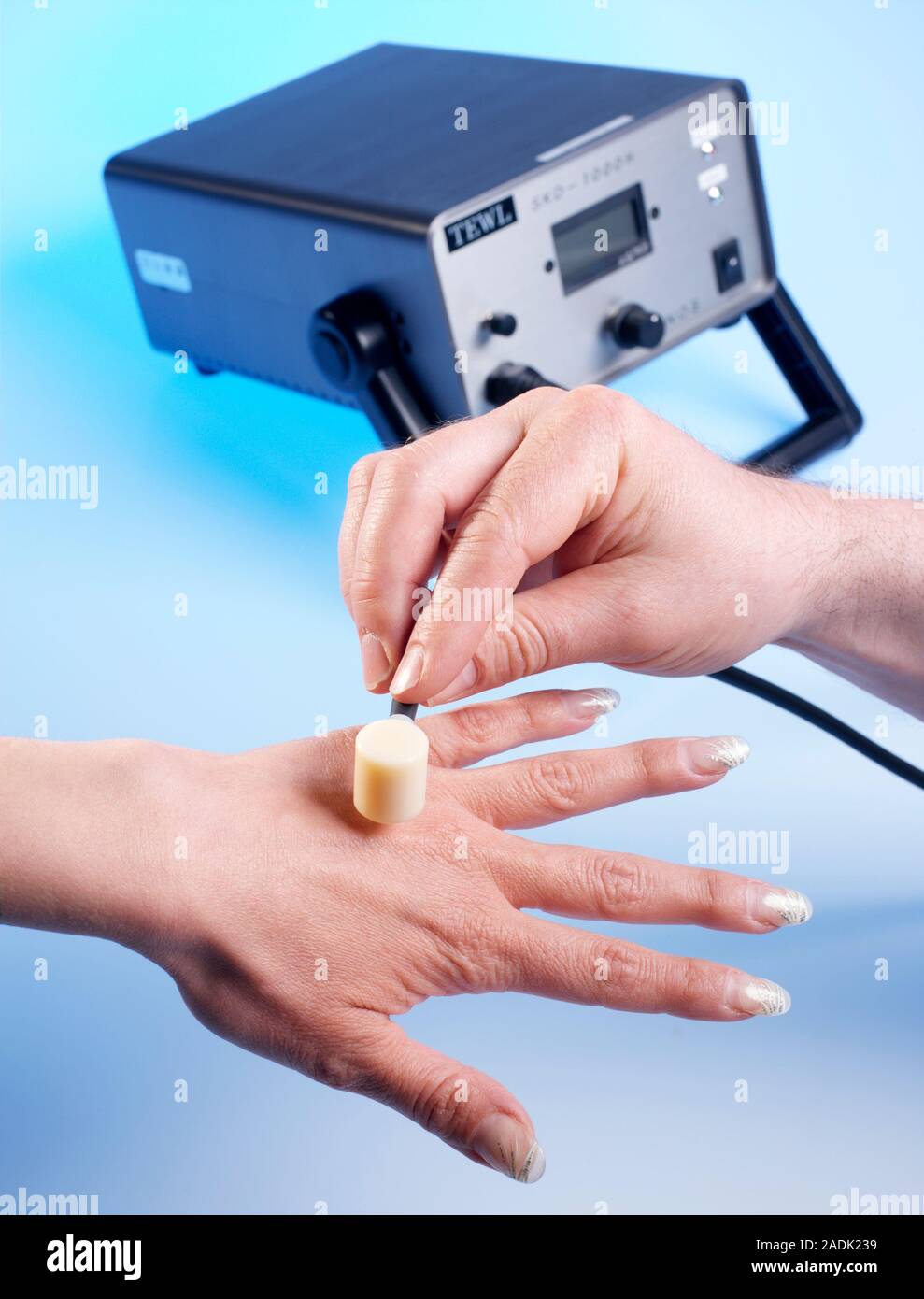 Measuring skin water loss. Dermatologist using an evaporimeter on a ...