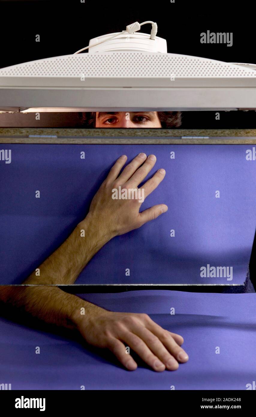 Cognitive experiment on a patient with phantom pain in a paralysed arm ...