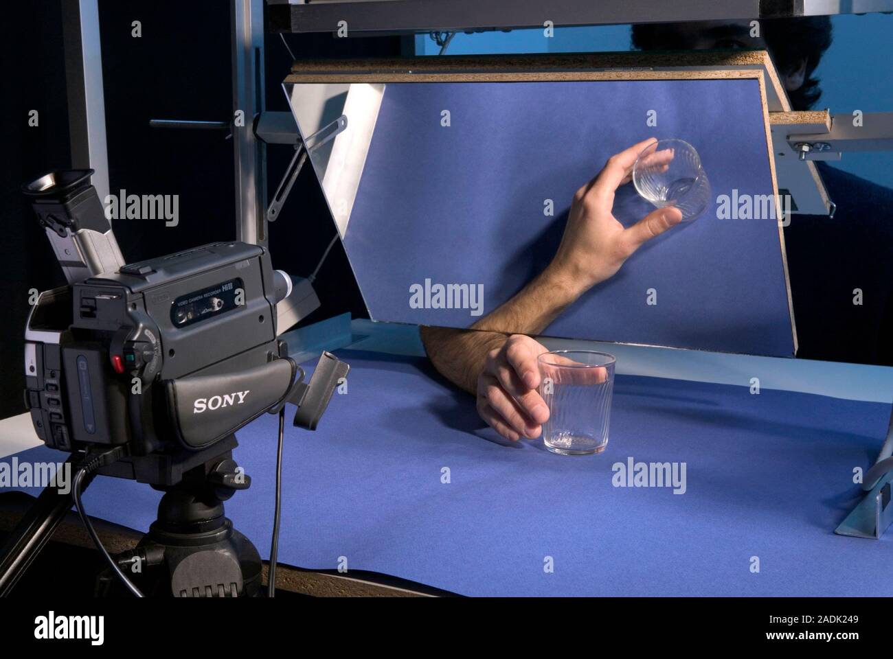 Cognitive experiment on a patient with phantom pain in a paralysed arm ...