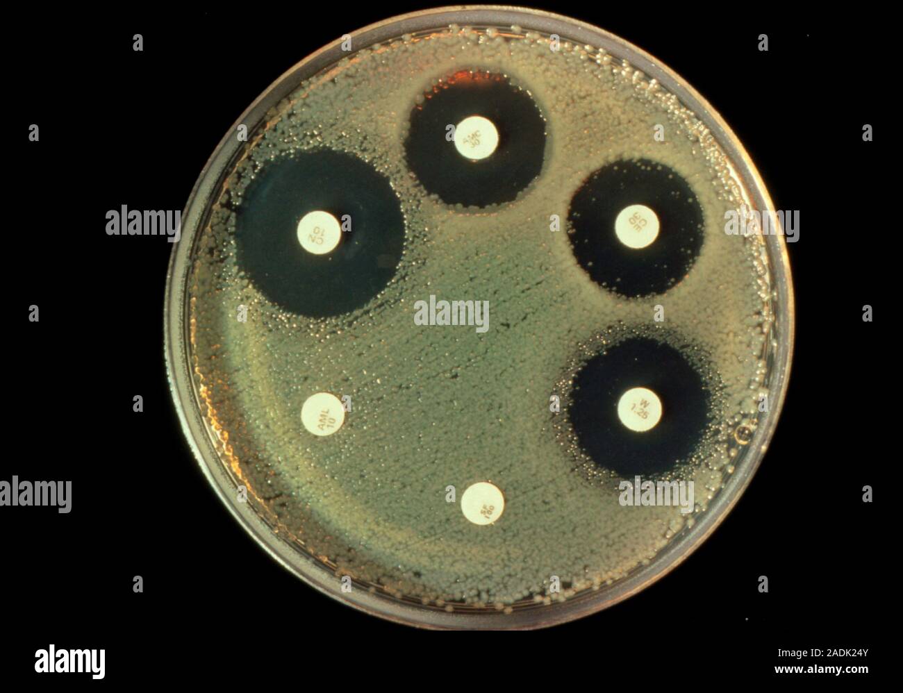 Antibiotic resistance in E.coli. Demonstration of a sensitivity test to ...