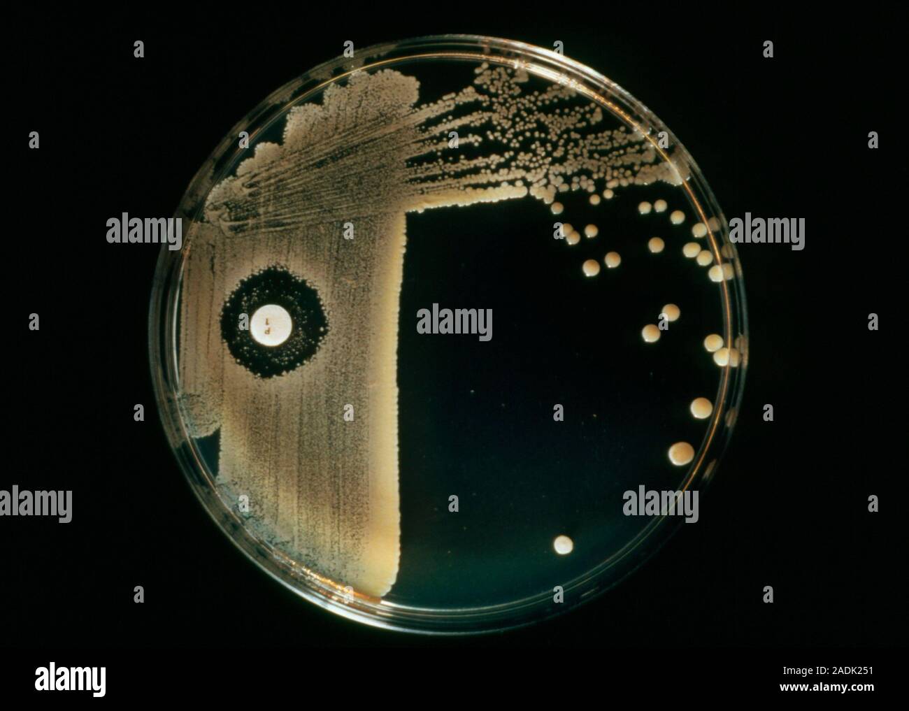 Culture of the bacteria Staphylococcus pyogenes (aureus), which is ...