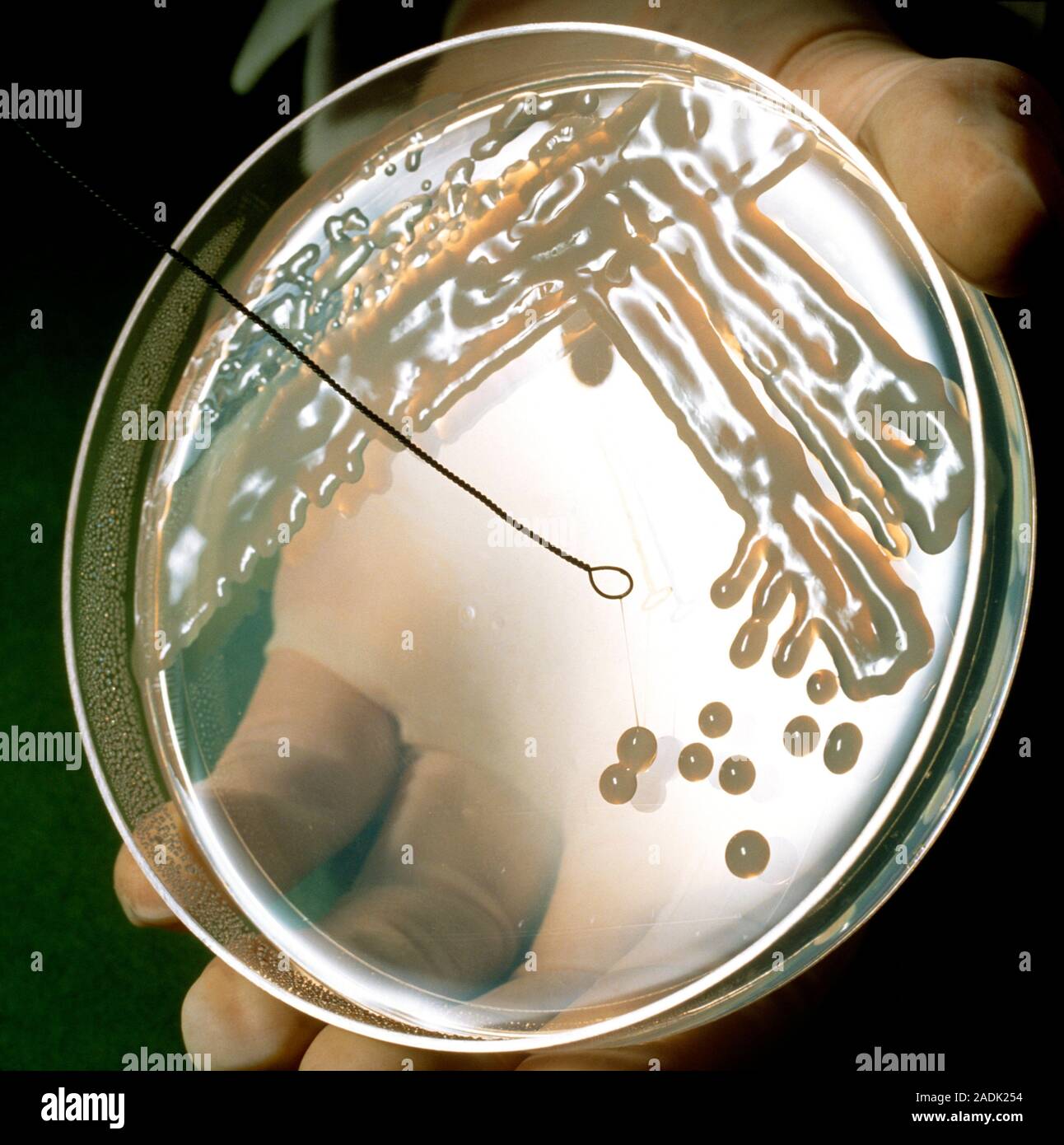 Petri dish culture of the bacterium Rhizobium leguminosarum, a nitrogen ...