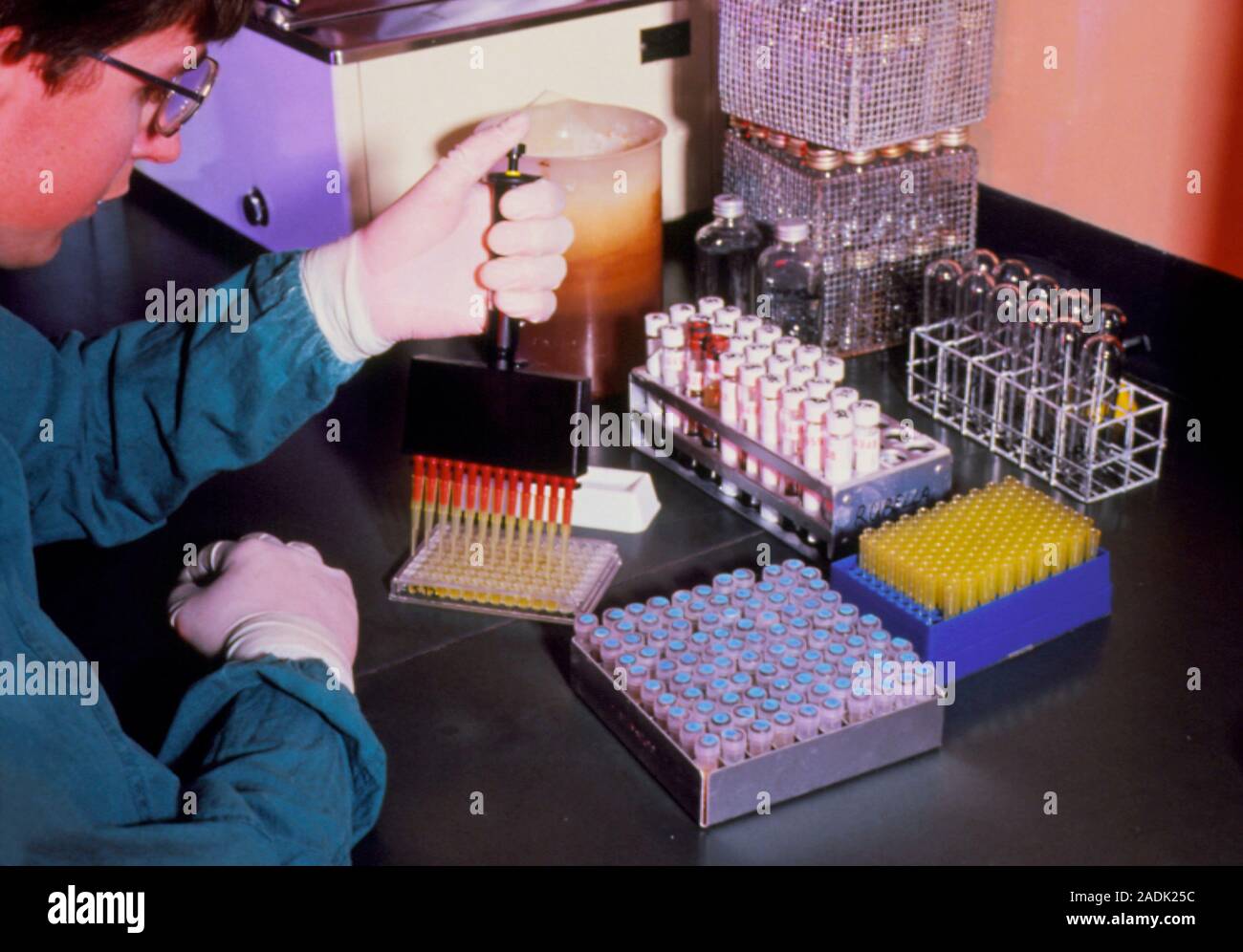 Microbiologist performing an ELISA (Enzyme-linked Immunoabsorbent Assay ...