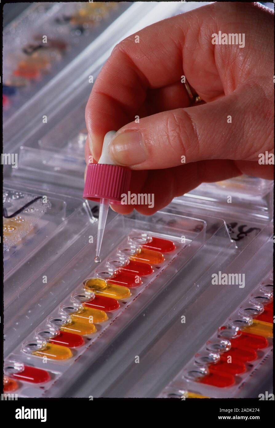 Laboratory technician performing an Analytical Profile Index (API) test ...