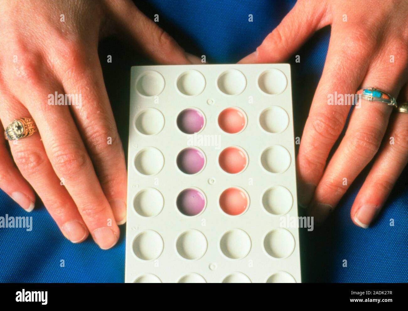 Influenza virus test. Tray of wells containing a diagnostic test for ...