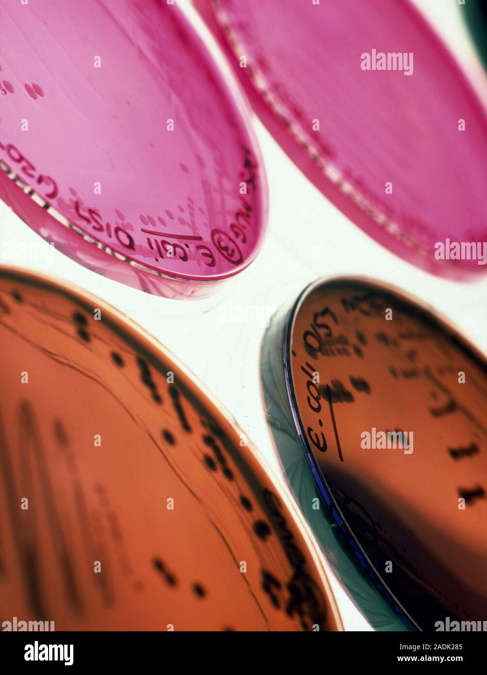 E. coli 0157:H7 bacterial cultures. Petri dish cultures showing ...
