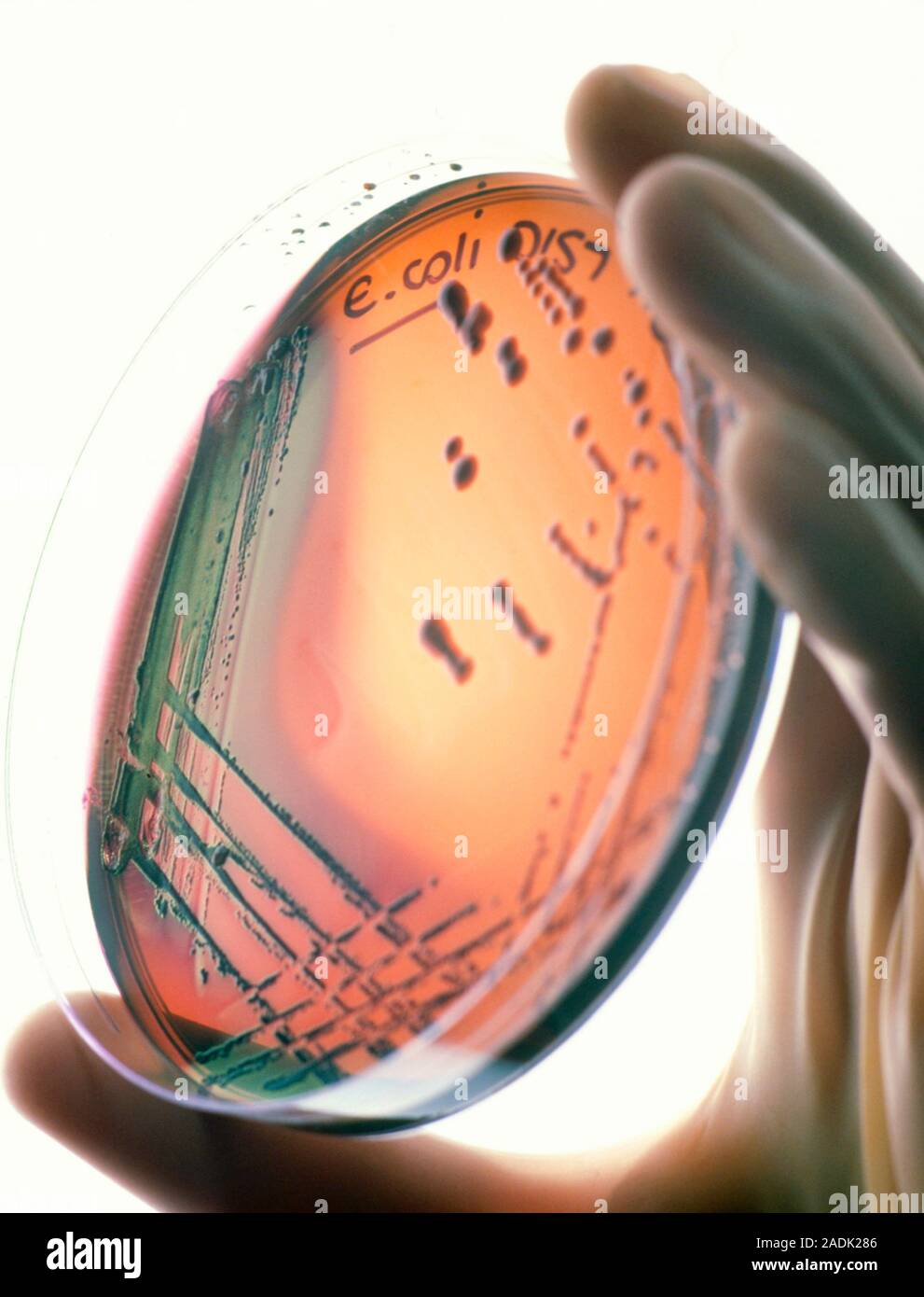 E. coli 0157:H7 bacterial culture. Gloved hand holding a petri dish ...