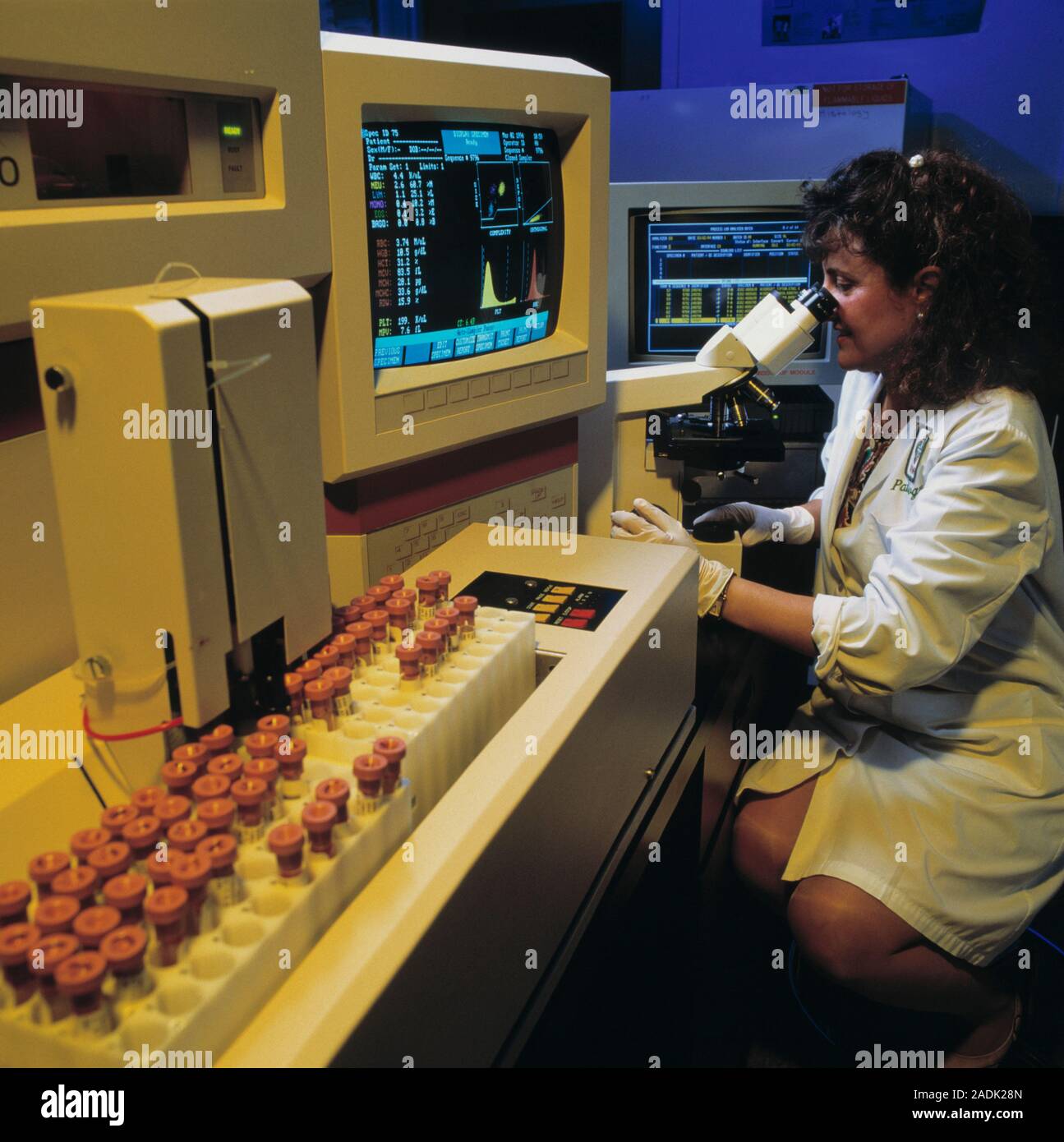 Pathology laboratory. Hospital pathologist uses a binocular microscope ...